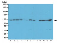 Anti-PKM2 Antibody | ABC438